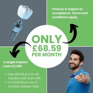 Cost of Dental Implants - Price Per Type + Monthly Payment Option