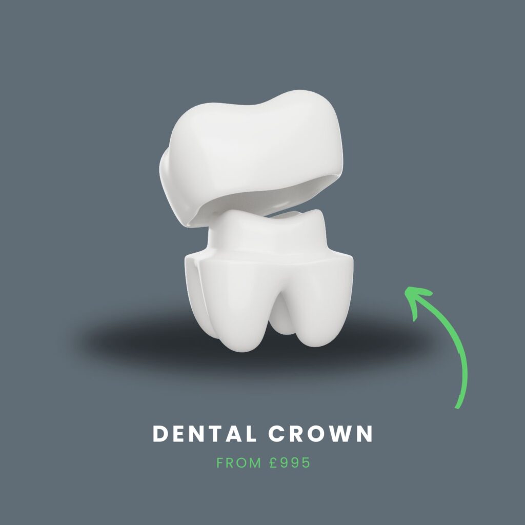 Emax Crown | The Better Crown Solution | Mint Dental SE1