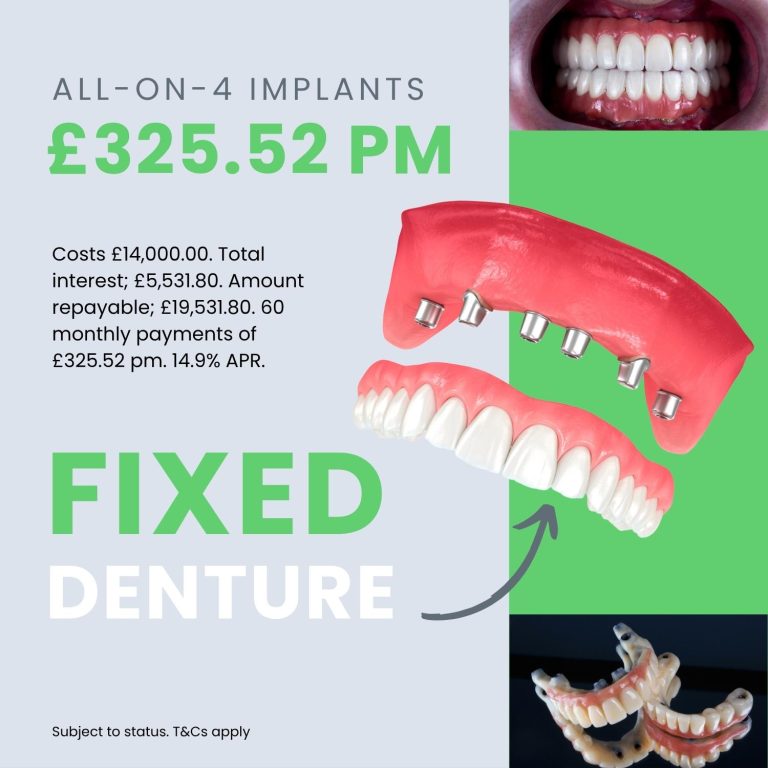Palateless Dentures | Dentures That You Can Wear All the Time
